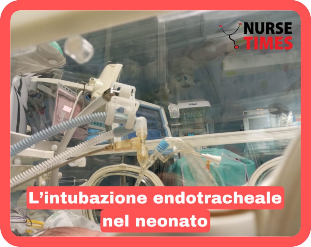 L’intubazione endotracheale nel neonato - Nurse Times