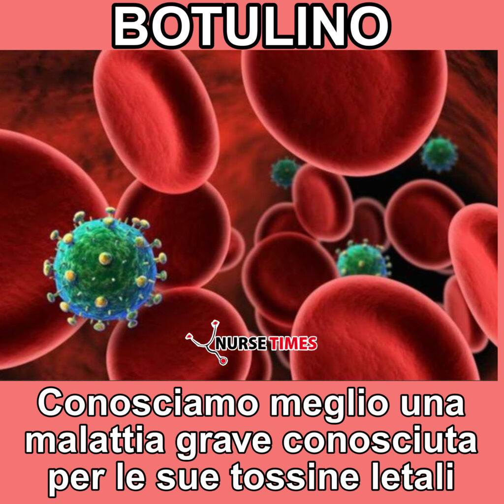 Tossina del botulino: meccanismi anatomici e fisiologici del “contagio ...